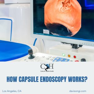 How Capsule Endoscopy Works | Gastroenterologist Los Angeles | Beverly ...